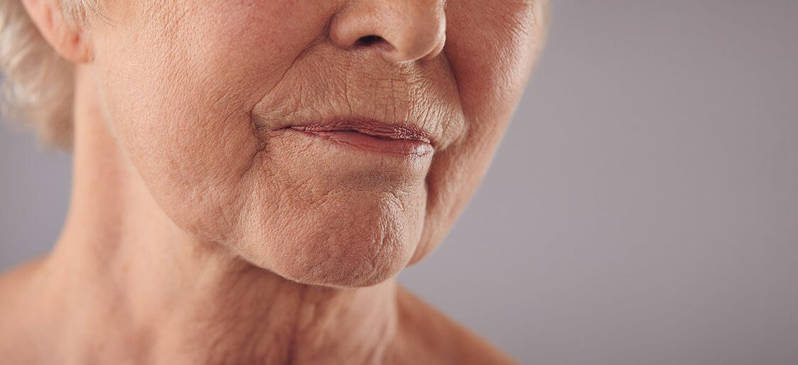 How To Reduce Neck Wrinkles Without Surgery 